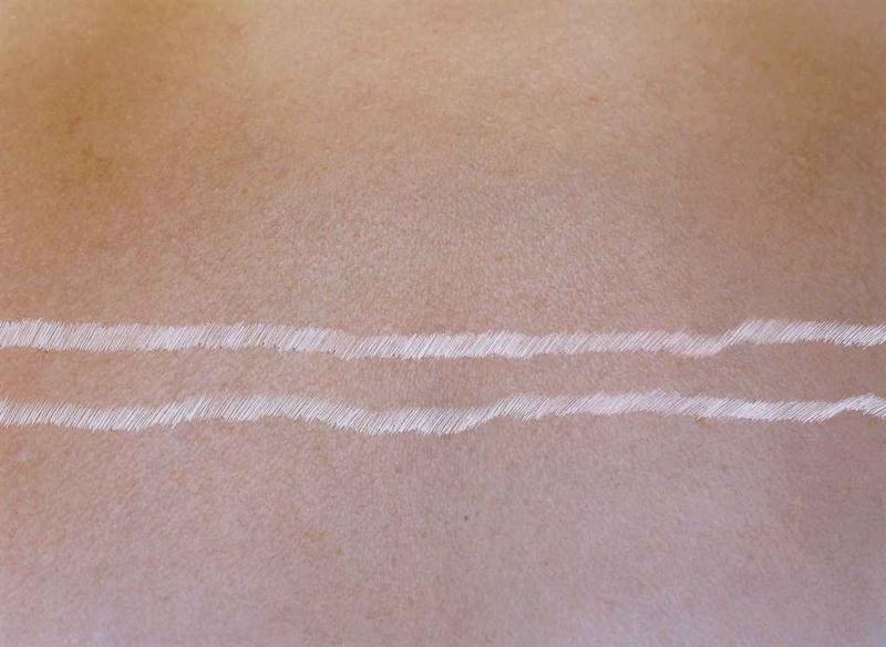 Hedayat Ghazaleh | Paper and Skin 4 (2008) | MutualArt