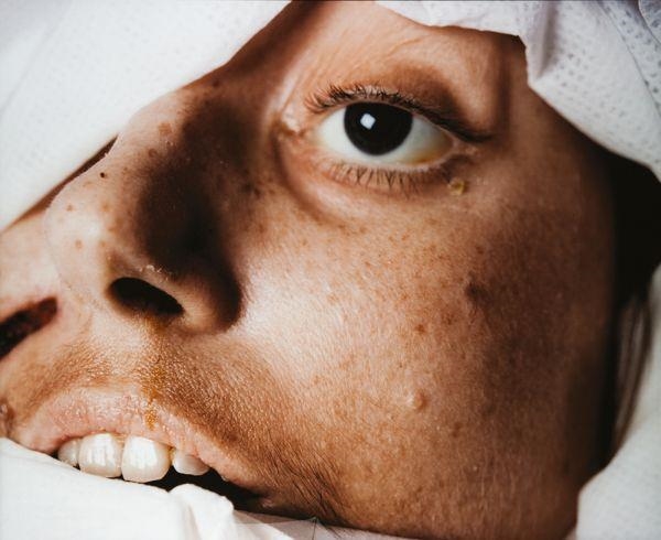 Andrés Serrano | Blood transfusion resulting in aids (the morgue series ...