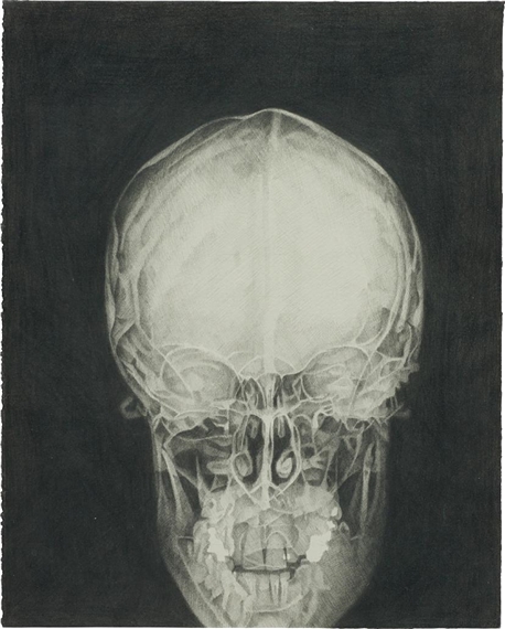 Tom Molloy | Self Portrait (2001 - 2002) | MutualArt