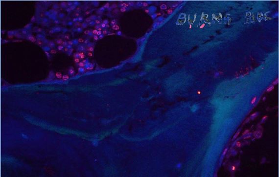 Hayden Dunham | Biography