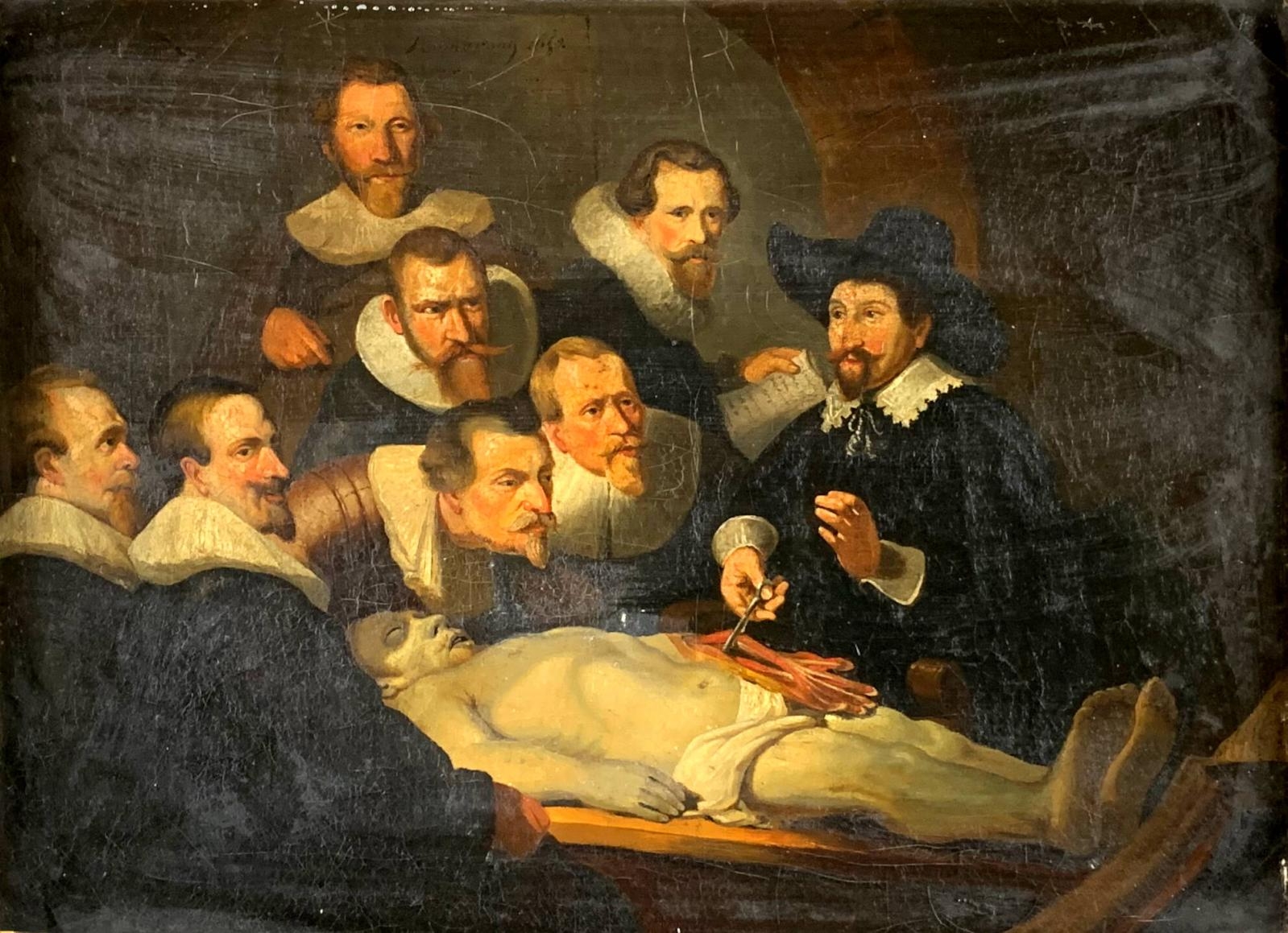 Rembrandt van Rijn | The anatomy lesson | MutualArt