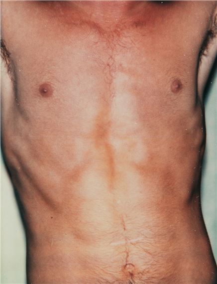 Andy Warhol | Torso. (Circa 1977) | MutualArt