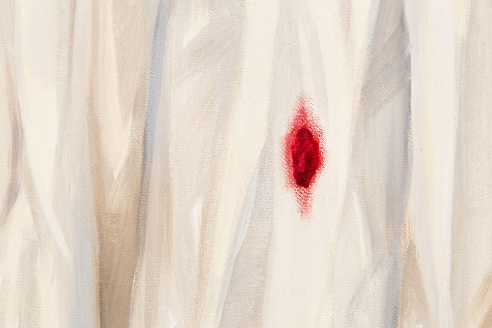 Agata Kus | Dress (2010) | MutualArt