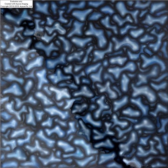 Hanna Rozpara | Granulaccumulation Hg (2022) | MutualArt