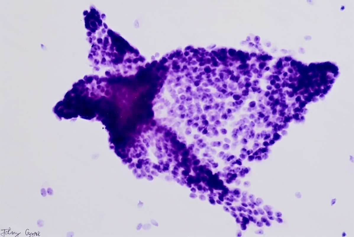 John Coyne | Pathology Images of Body Cells | MutualArt