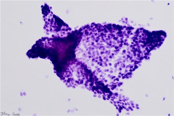 John Coyne | Pathology Images of Body Cells | MutualArt