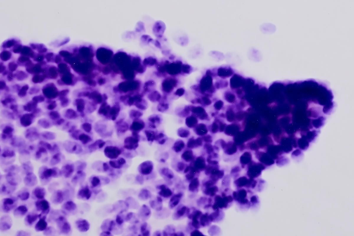 John Coyne | Pathology Images of Body Cells | MutualArt