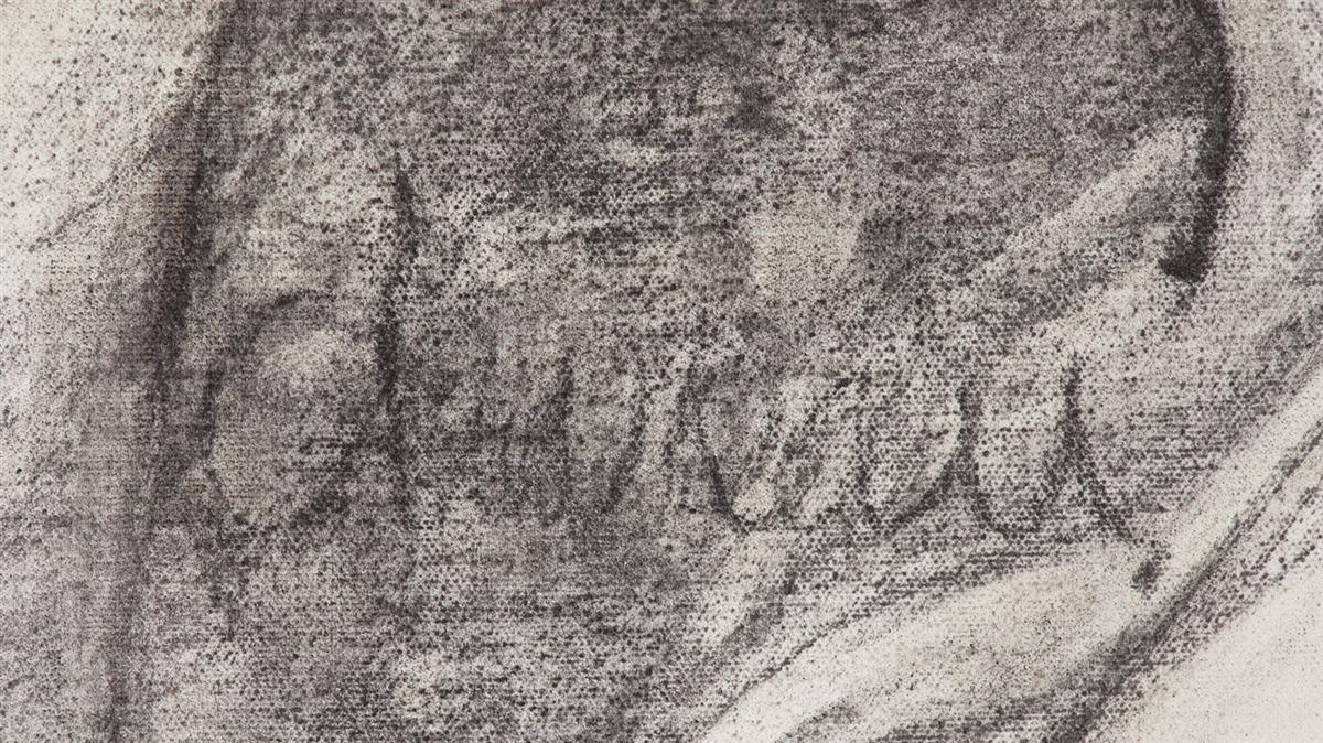 George Valentine Dureau | Portrait of an Amputee (2004) | MutualArt