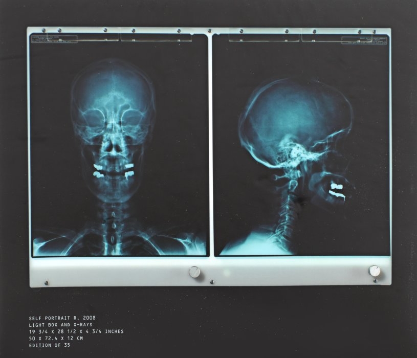 Damien Hirst | Self Portrait X-Ray (2008) | MutualArt