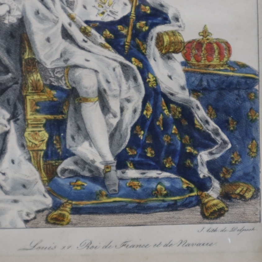 François-Séraphin‏ Délpech | Delpech, François-Séraphin (1778-1825 ...