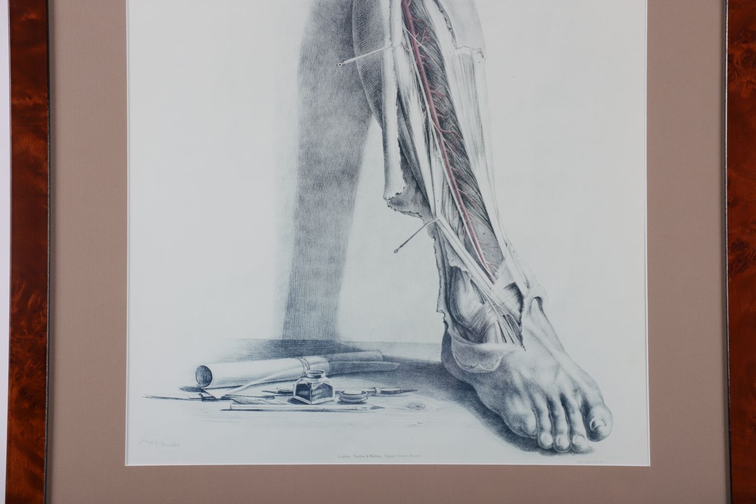 Joseph Maclise | Tibial Exposure | MutualArt