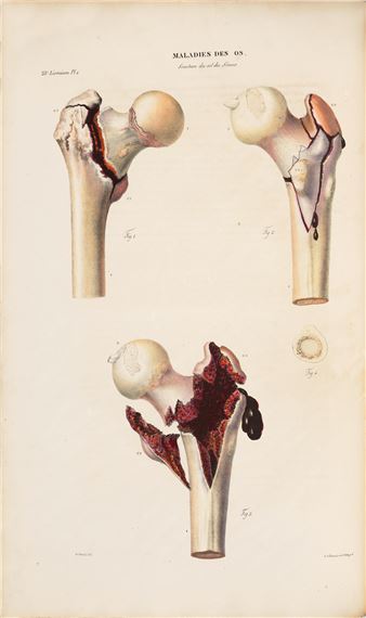 Antoine Toussaint de Chazal | Anatomie pathologique du corps humain ...