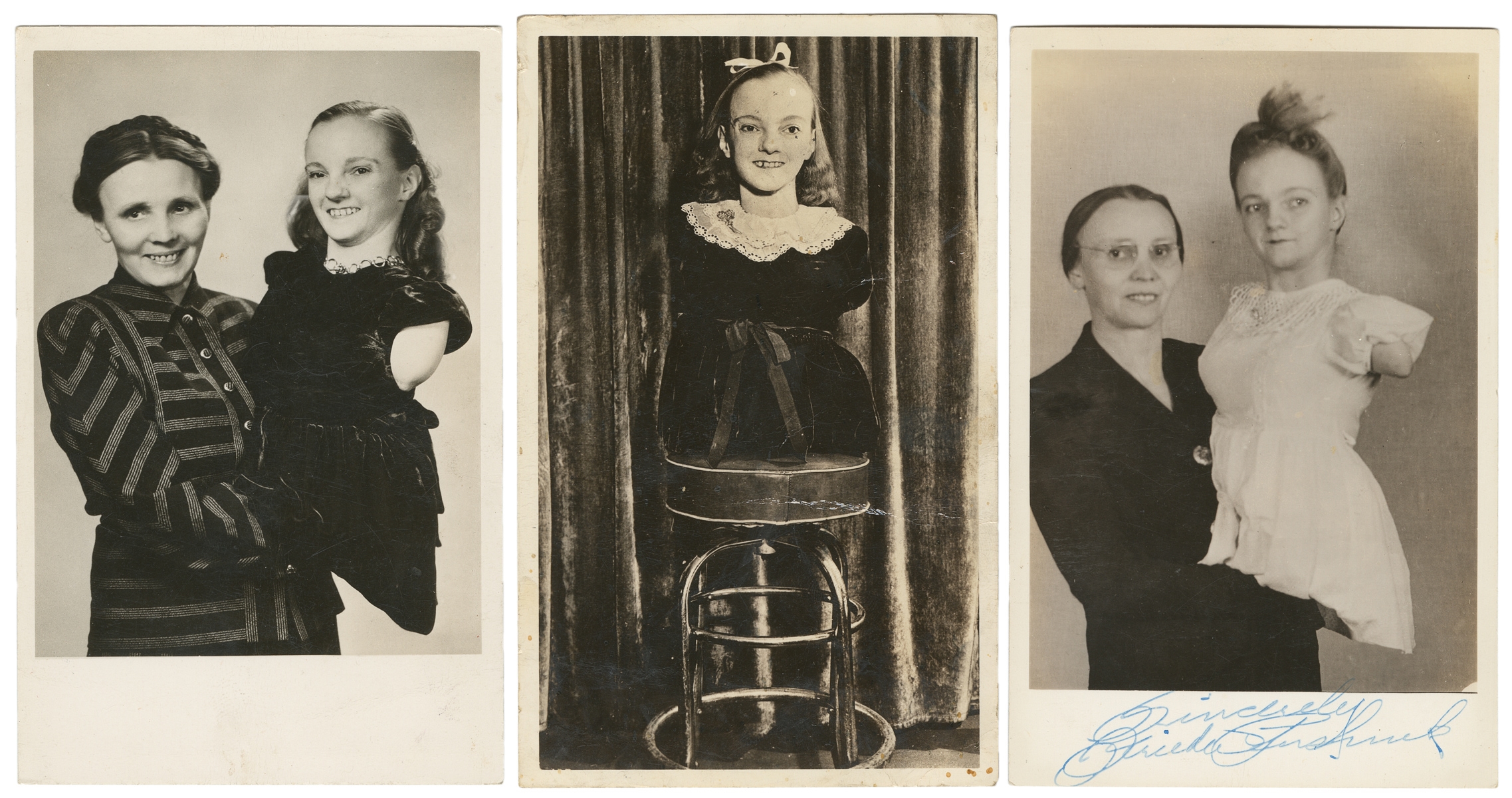 Frieda Pushnik | “The Armless and Legless Wonder / Three Signed RPPCs ...