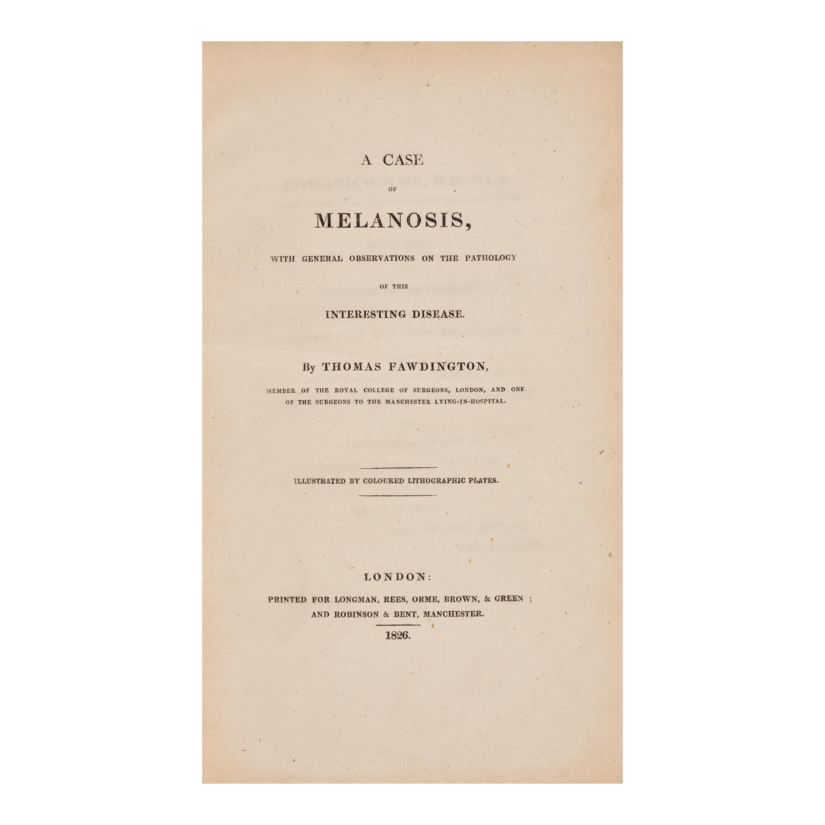Thomas | A Case of Melanosis, with General Observations on the ...